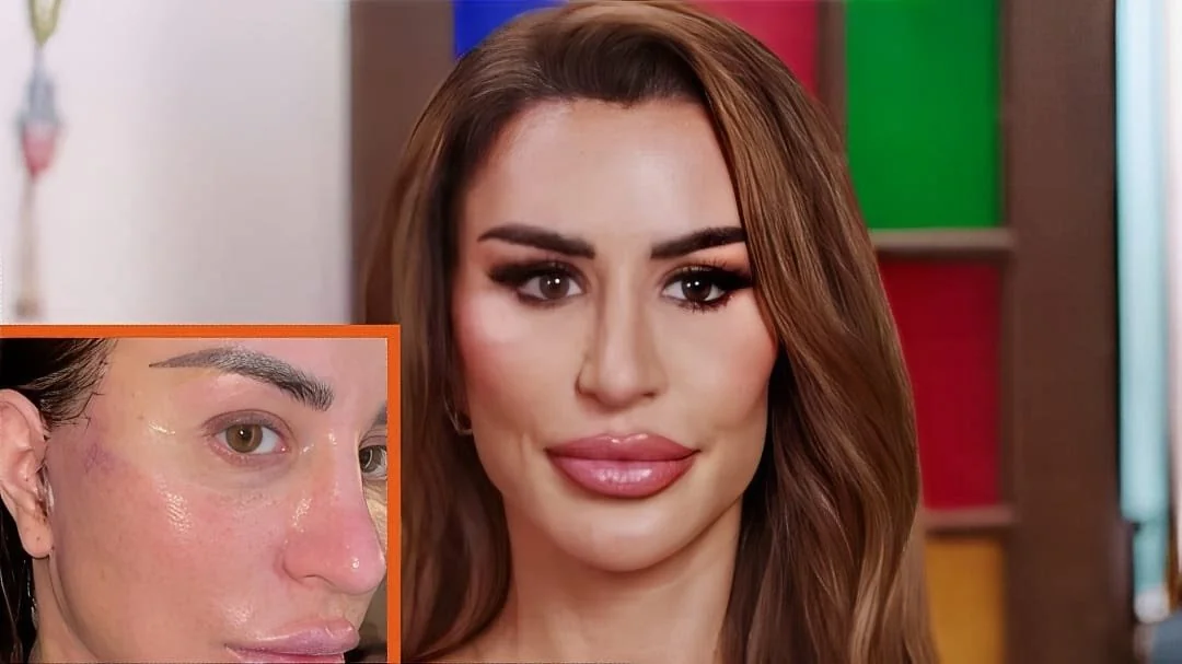 Shekinah Garner Reveals the True Motivation Behind Her Third Facelift ...