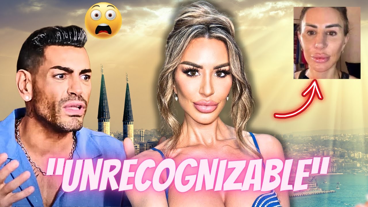 Shekinah Garner’s Plastic Surgery Transformation: Beauty or Disaster ...